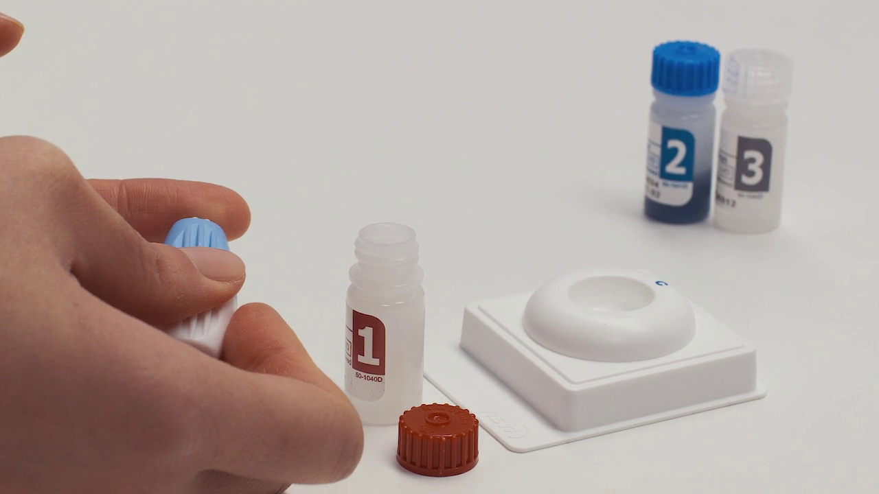 L’autotest du VIH changera-t-il la donne?